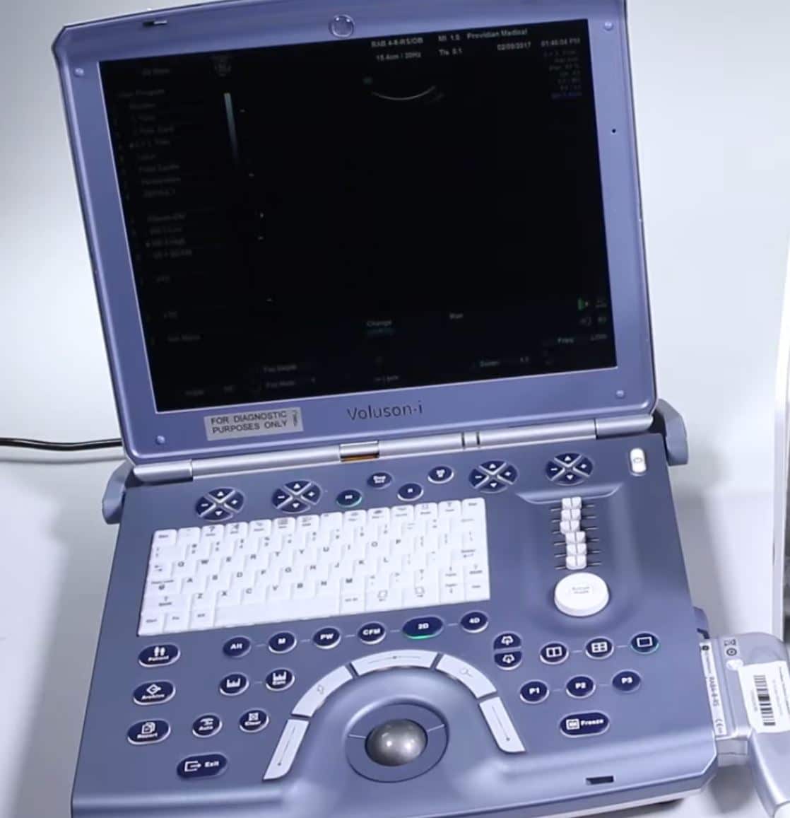Perfecting 4D Ultrasound: 4D Ultrasound Imaging Basics | Probo Medical