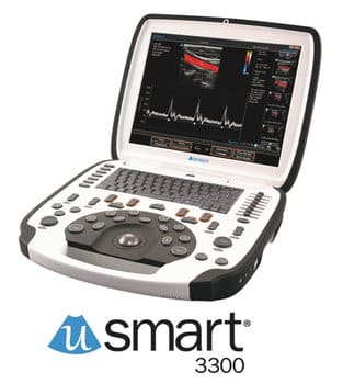 Terason uSmart 3300 | Probo Medical