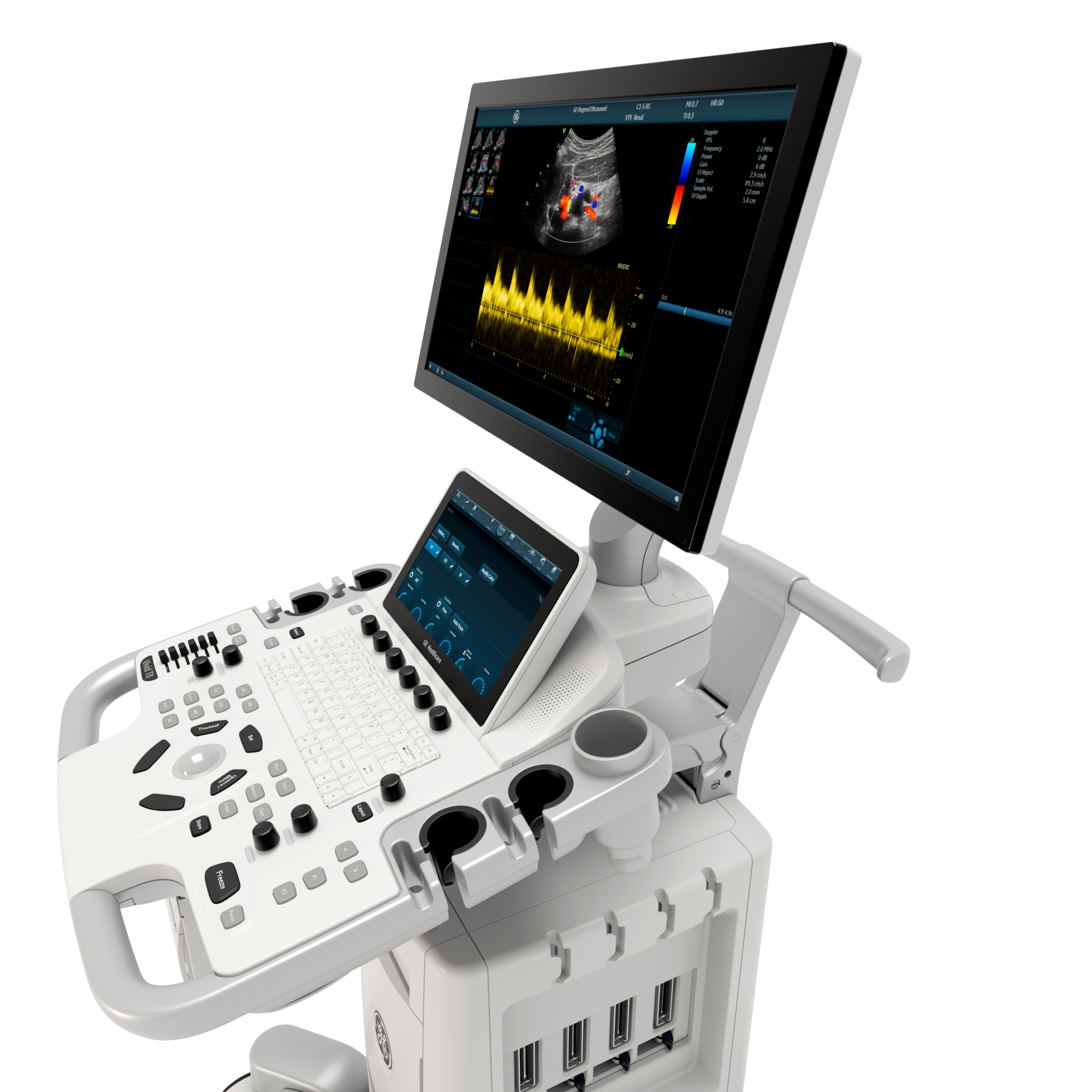 GE HealthCare Vivid T8 Ultra Edition | Probo Medical