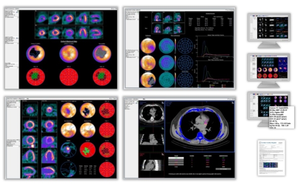 INVIA Upgrades | Probo Medical