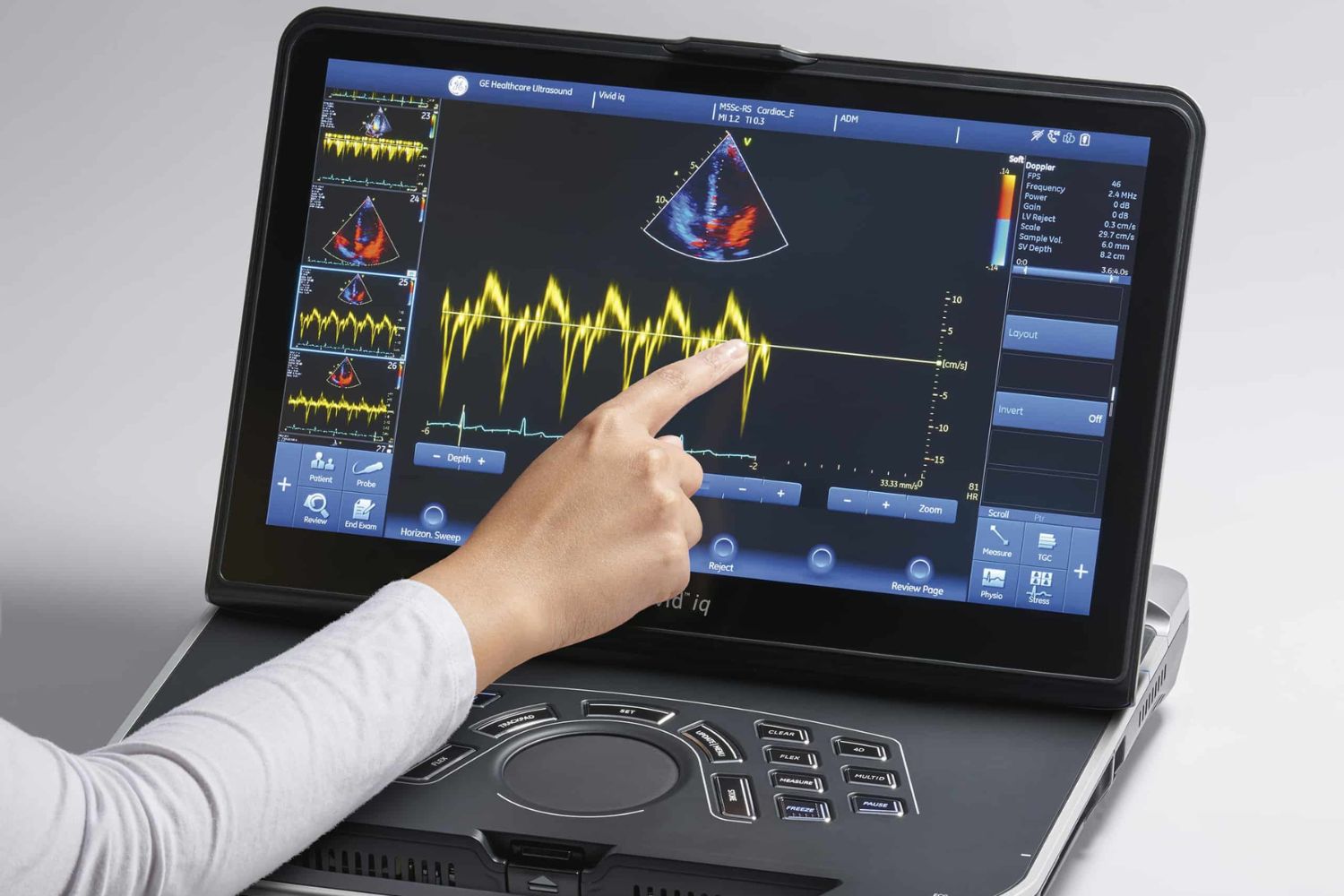 LP - GE HealthCare Vivid iq | Probo Medical