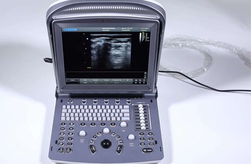 Chison ECO 6 Video Ultrasound Training series | Probo Medical