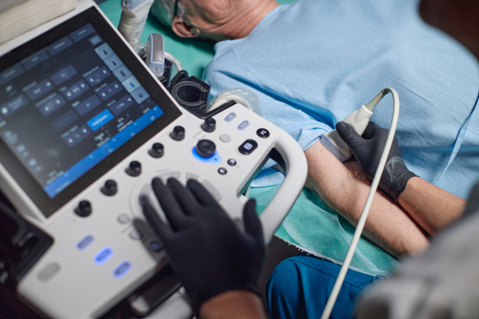 2026 Ultrasound Machine Buyer's Guide: Prices & Top Brands | Probo Medical